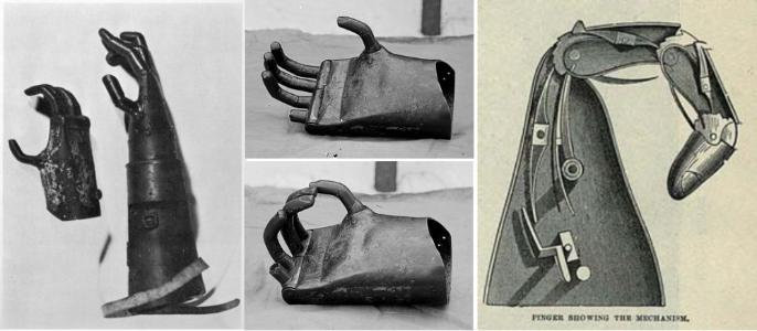 Prosthetic Limbs - Suggestions - Vintage Story